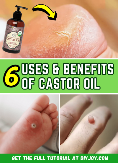 6 Surprising Uses & Benefits of Castor Oil - DIY Joy