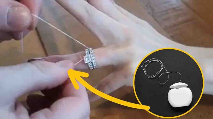 3 Ways to Remove a Ring Stuck on Your Finger - DIY Joy