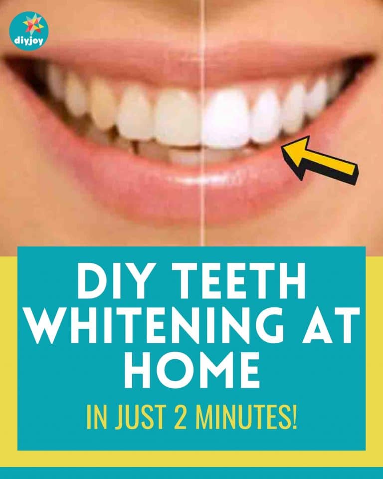 DIY Teeth Whitening at Home in 2 Minutes